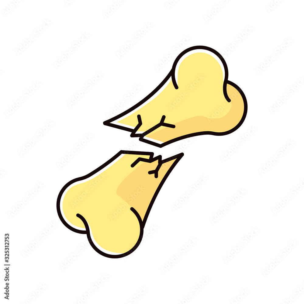 Bone fracture RGB color icon. Oblique displaced fracture. Accident ...