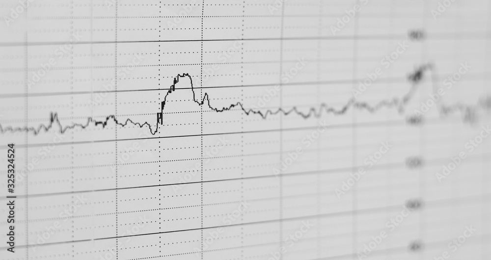 ecg graph, electrocardiogram ekg on paper Stock Photo | Adobe Stock