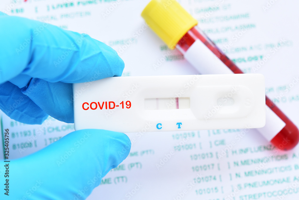 Positive test result by using rapid test device for COVID-19, novel ...