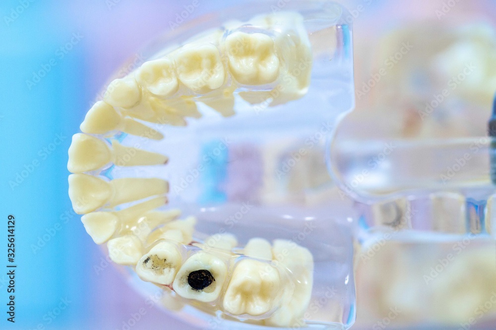 Closeup on dental model on a pastel background. Milk and permanent ...