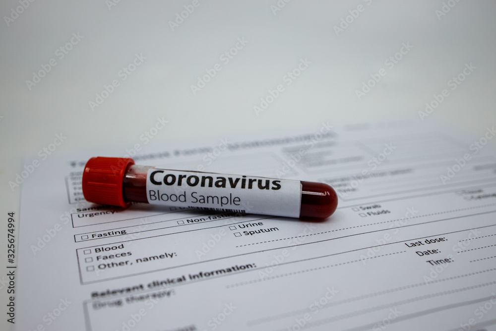 Blood sample for the new rapidly spreading Coronavirus that originated ...