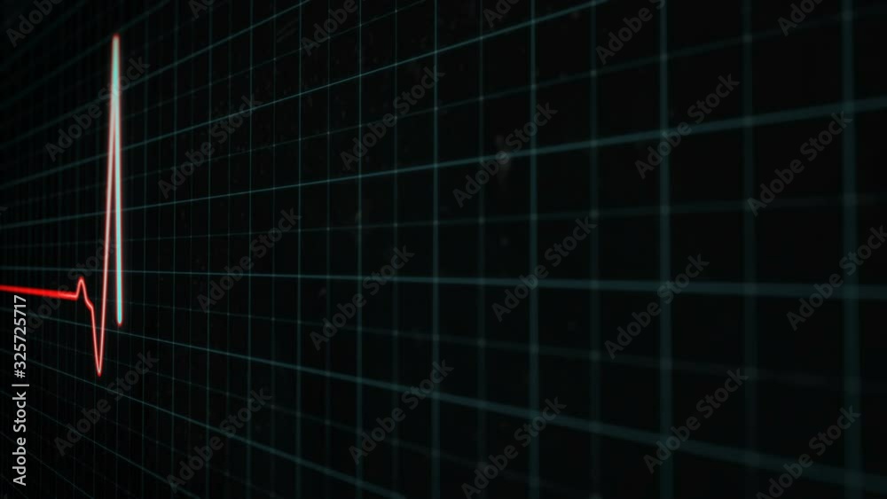 Heartbeat flatline on EKG ECG screen in close-up. Heartrate monitor ...