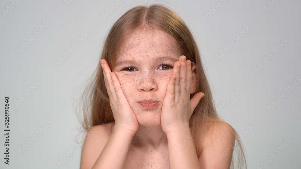 little Girl with freckles holds hands her cheeks Stock Photo | Adobe Stock