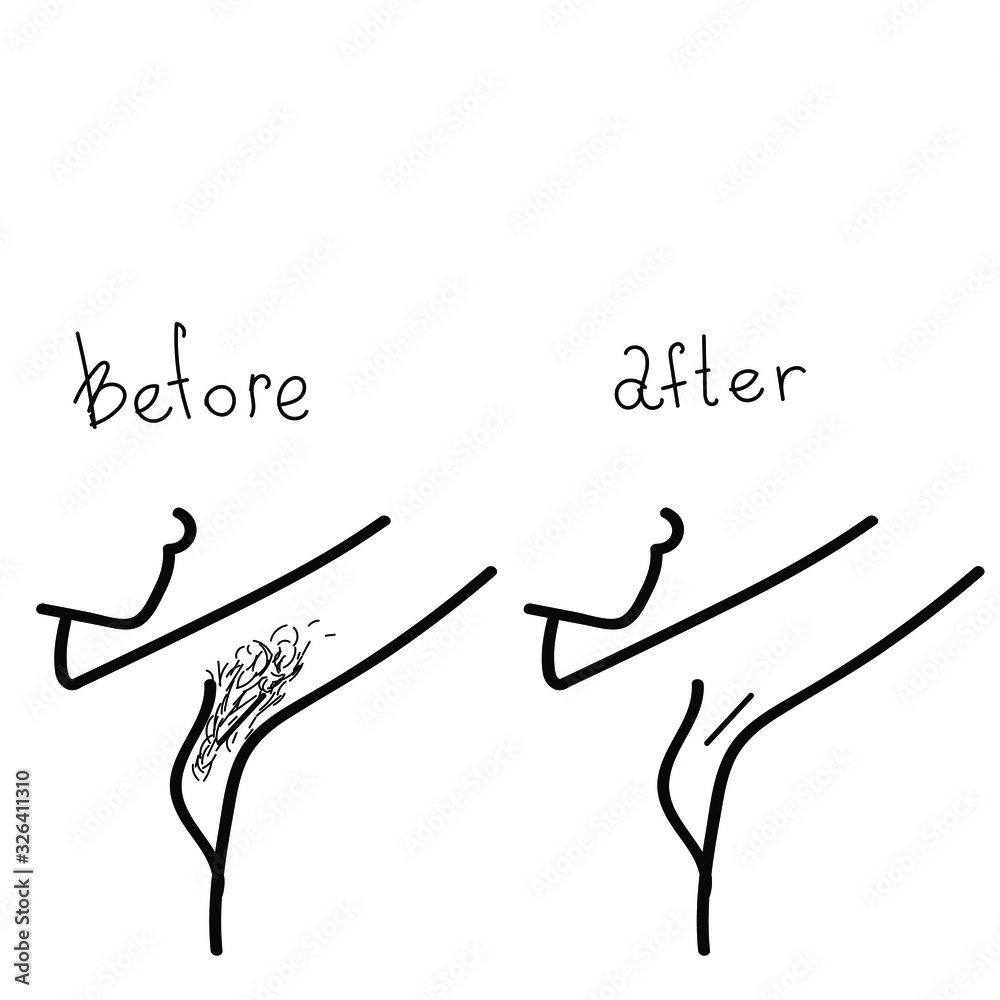 Before and after transformation process. Woman beauty procedures ...