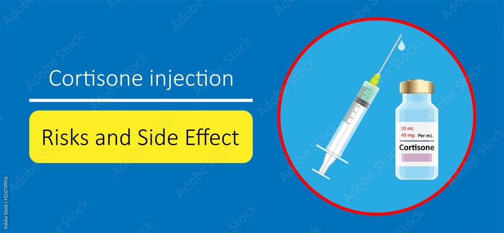 Cortisone shots injection epidural steroid ESI lumbar back spinal ...