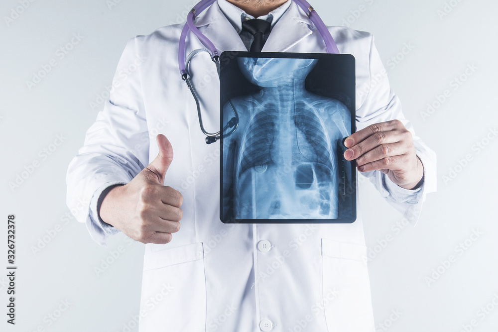 Doctor examining chest x-ray film of patient at hospital. Stock Photo ...