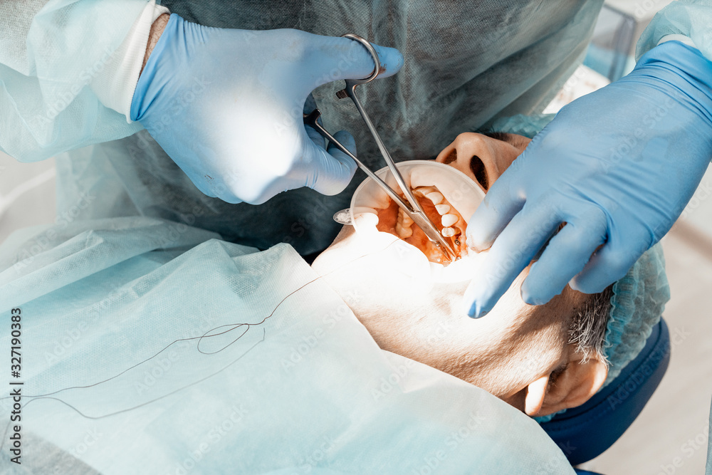 Patient and dentist during implant placement operation. Real operation ...