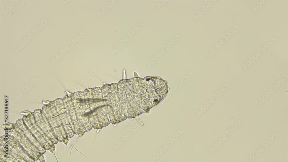 Phalacrophorus pictus worm under a microscope, family Iospilidae, class ...