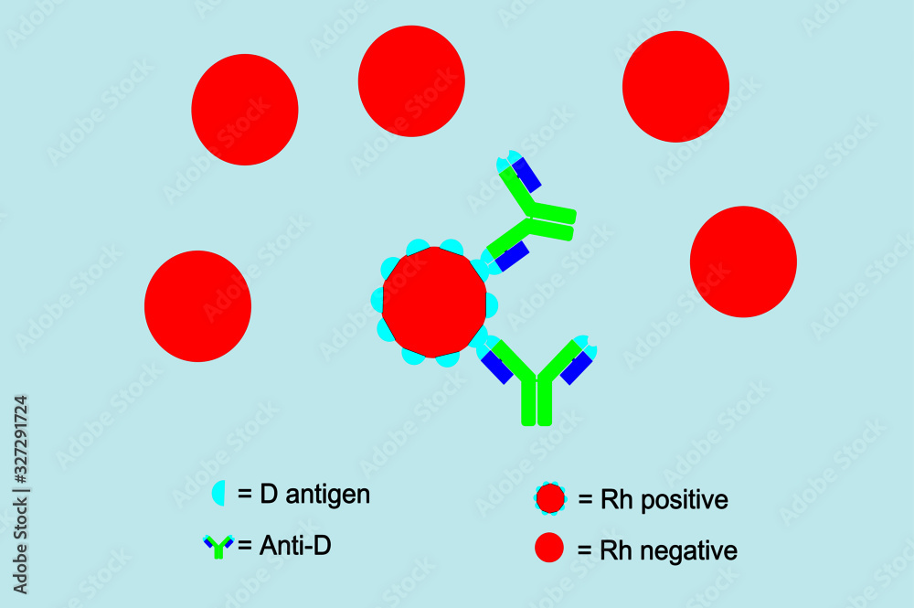 Anti-D binding with D antigen and not binding on rh negative blood, Rh ...