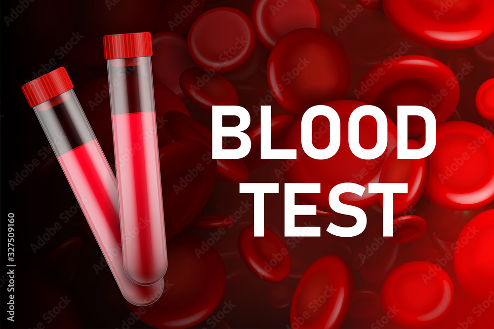 Creative vector illustration of blood test background, Hematology ...