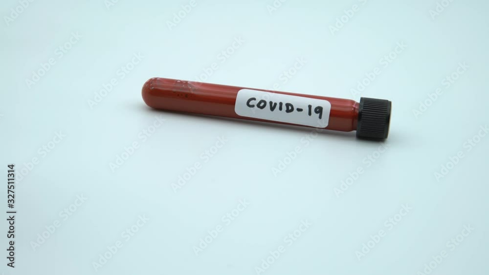 4K, Blood sample tube for corona test, COVID-19. The virus has caused ...