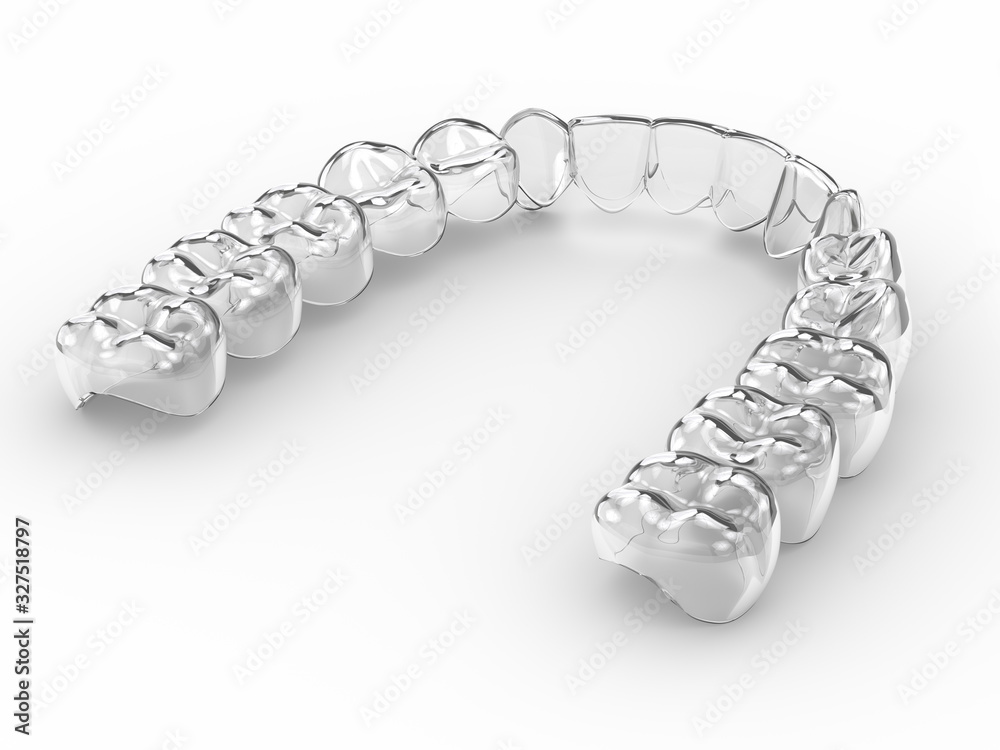 3d render of invisalign removable retainer Stock Illustration | Adobe Stock