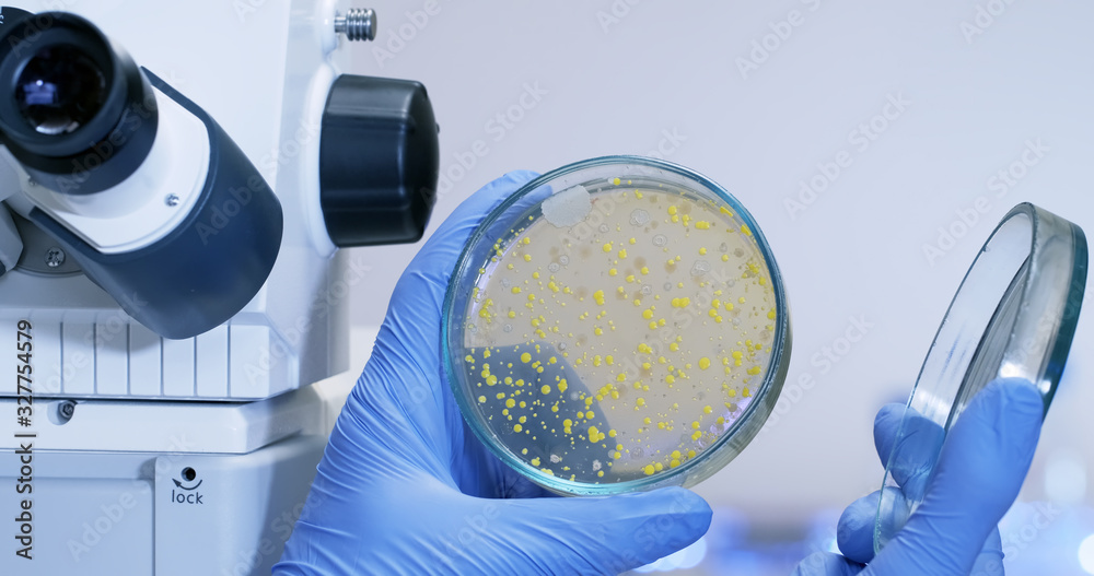 Colonies of bacteria in a Petri dish, the scientist holds in his hand ...