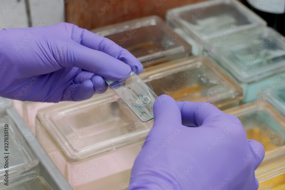 mounting slide by cover glass , staining slide Pap smear for cytology ...