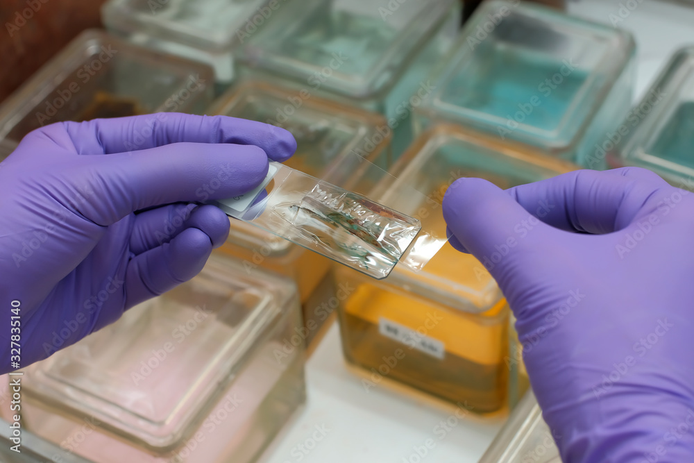 mounting slide by cover glass , staining slide Pap smear for cytology ...