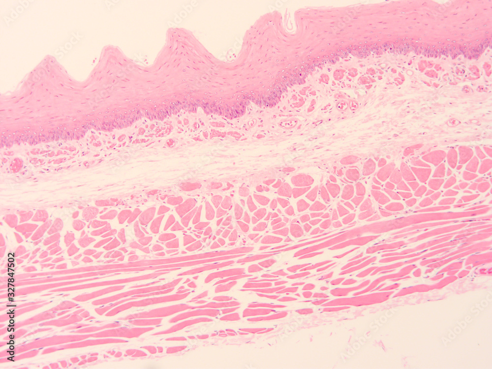 picture of histology human tissue with microscope from laboratory (not ...