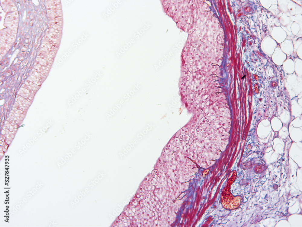picture of histology human tissue with microscope from laboratory (not ...