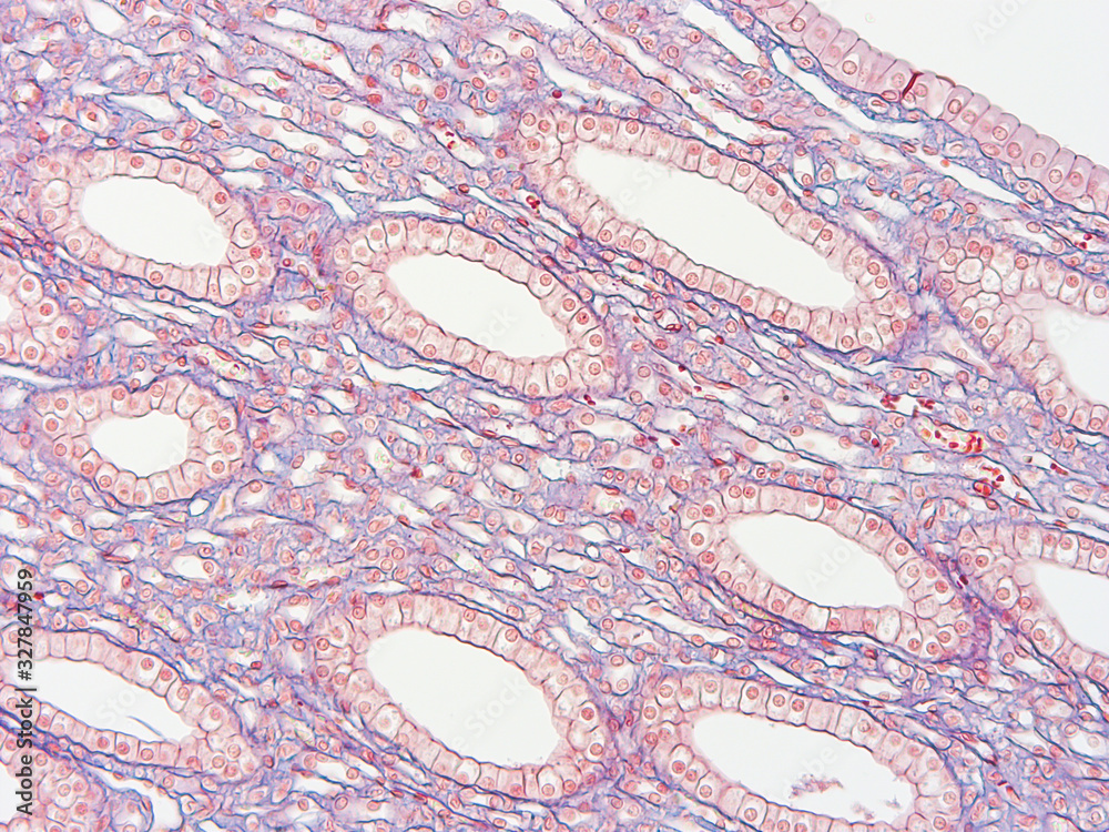 picture of histology human tissue with microscope from laboratory (not ...