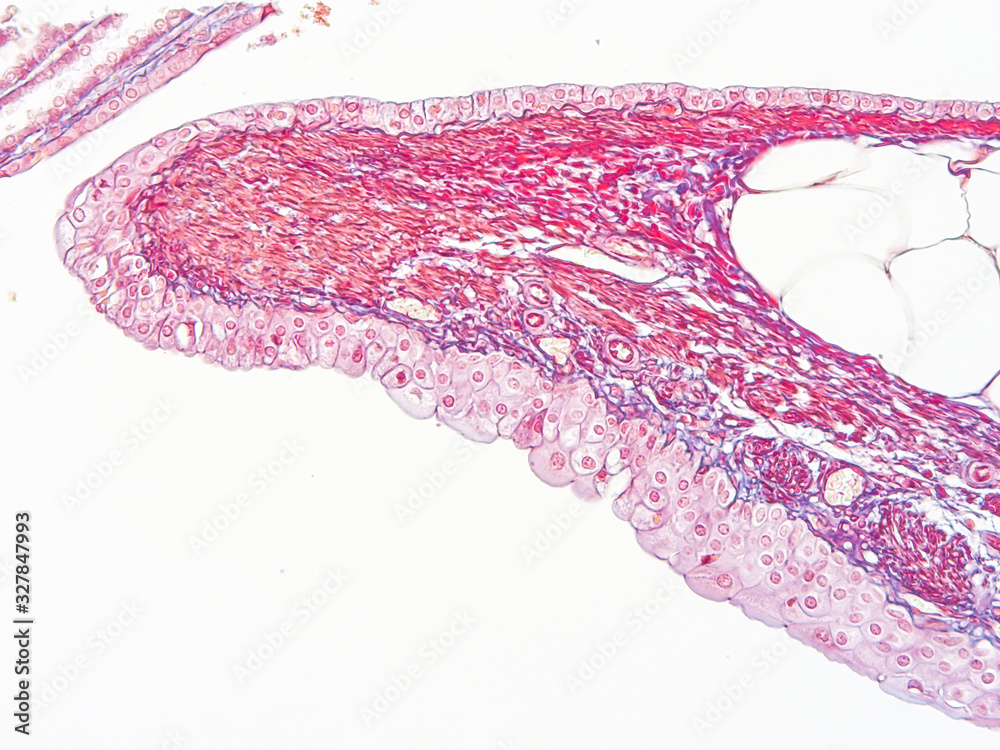 picture of histology human tissue with microscope from laboratory (not ...
