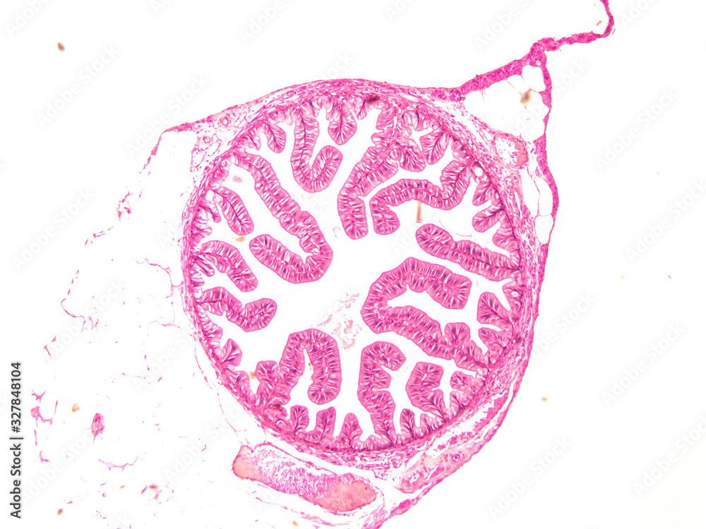 picture of histology human tissue with microscope from laboratory (not ...