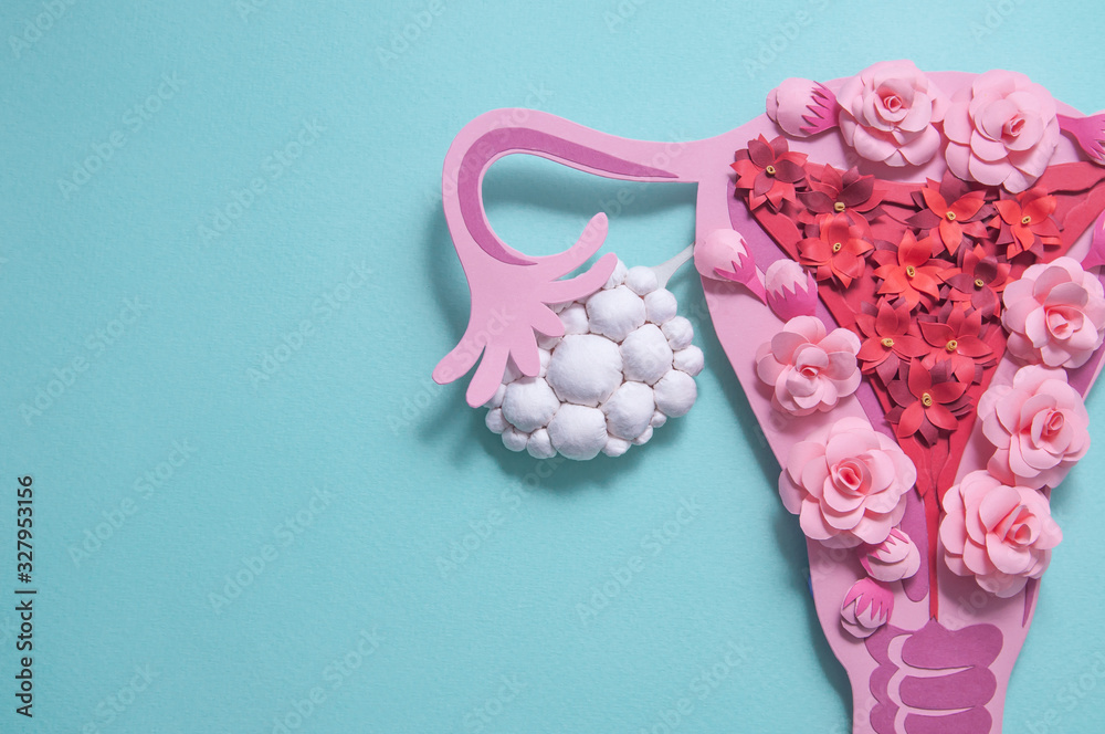 Concept polycystic ovary syndrome, PCOS. Women reproductive system ...