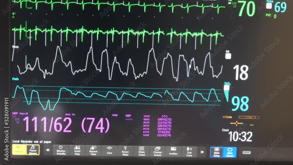 Handheld view of a hospital vital signs monitor screen showing wave ...
