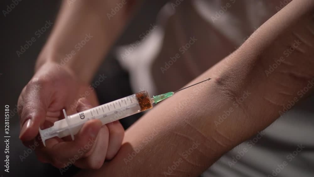 Closeup of a person with scars all over his arms injecting a liquid ...