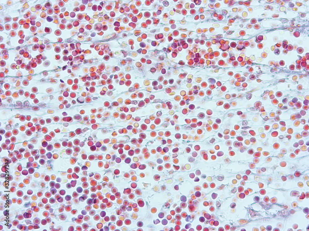 Histology of human tissue, show epithelial tissue and connective tissue ...