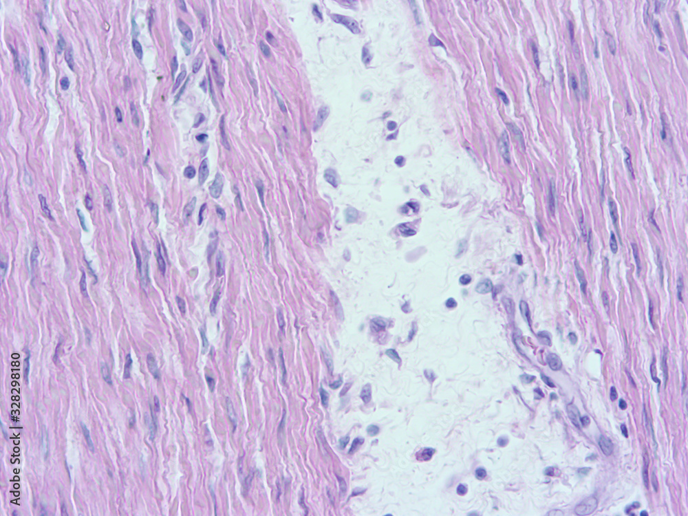picture of histology human tissue with microscope from laboratory (not ...