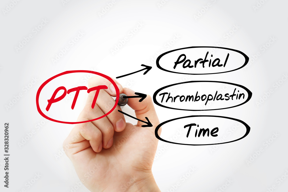 PTT - Partial Thromboplastin Time acronym, medical concept background ...