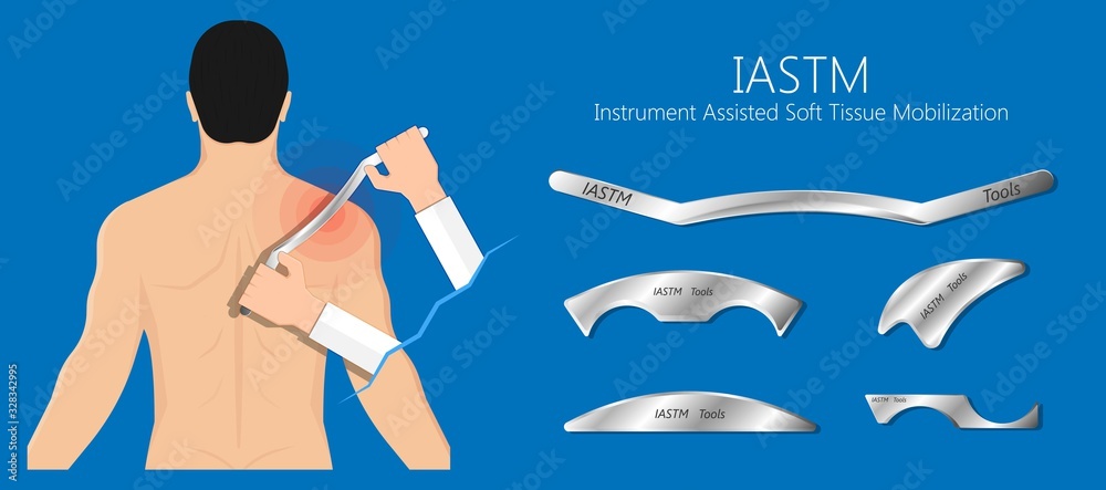 Instrument Assisted Soft Tissue Mobilization IASTM treat injury illness ...