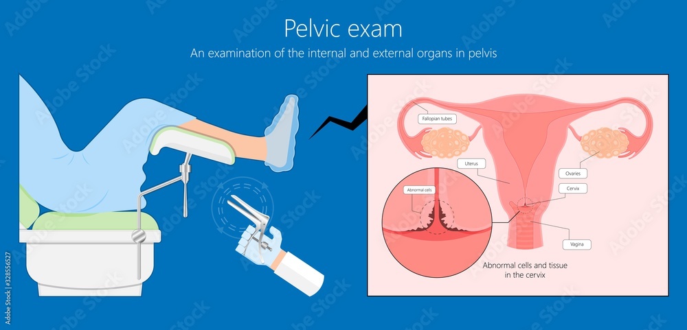 Cold knife cone biopsy Loop Electrosurgical Excision Procedure LEEP ...