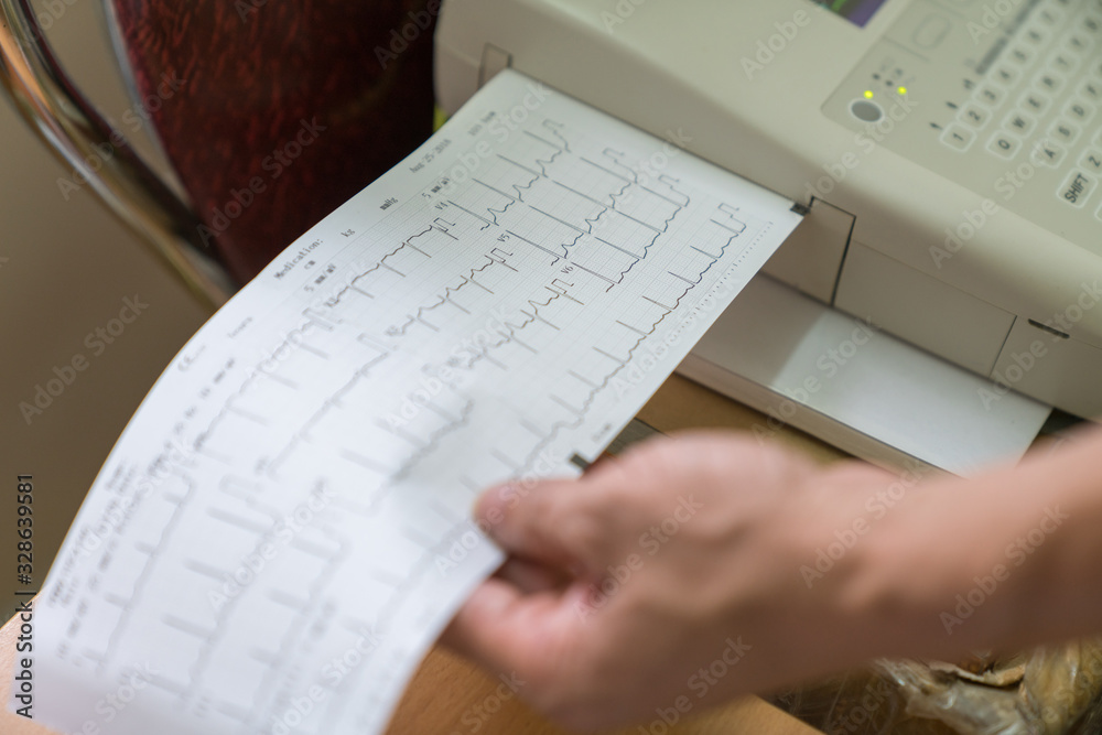 Printing of cardiogram report coming out from Electrocardiograph in ...