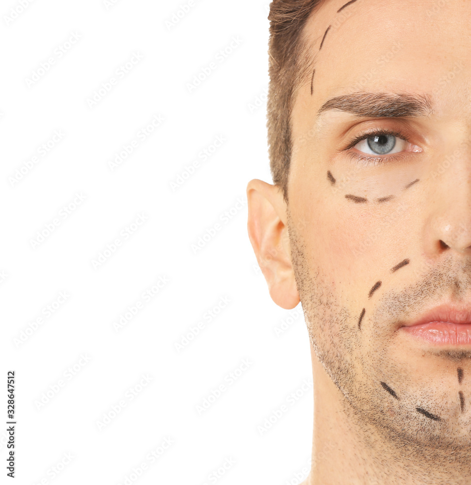 Young man with marks on his face against white background. Concept of ...