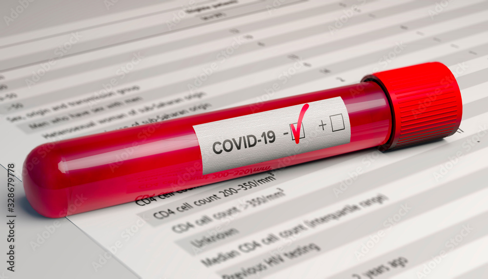 Covid-19 test tube, negative swab and positive swab. Swab sample ...