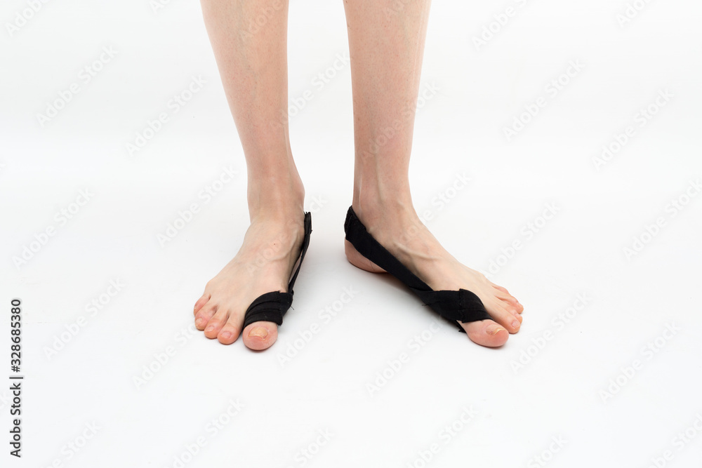 stabilizing orthosis for the correction of the big toe on the woman ...