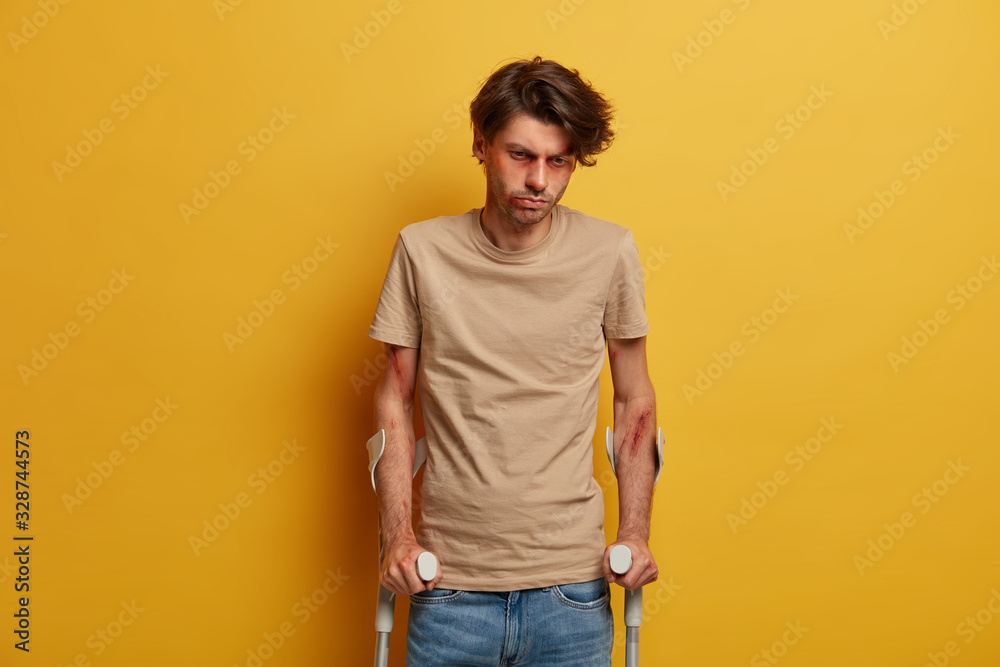 Disabled handicapped bruised man looks sadly down, cannot walk himself ...