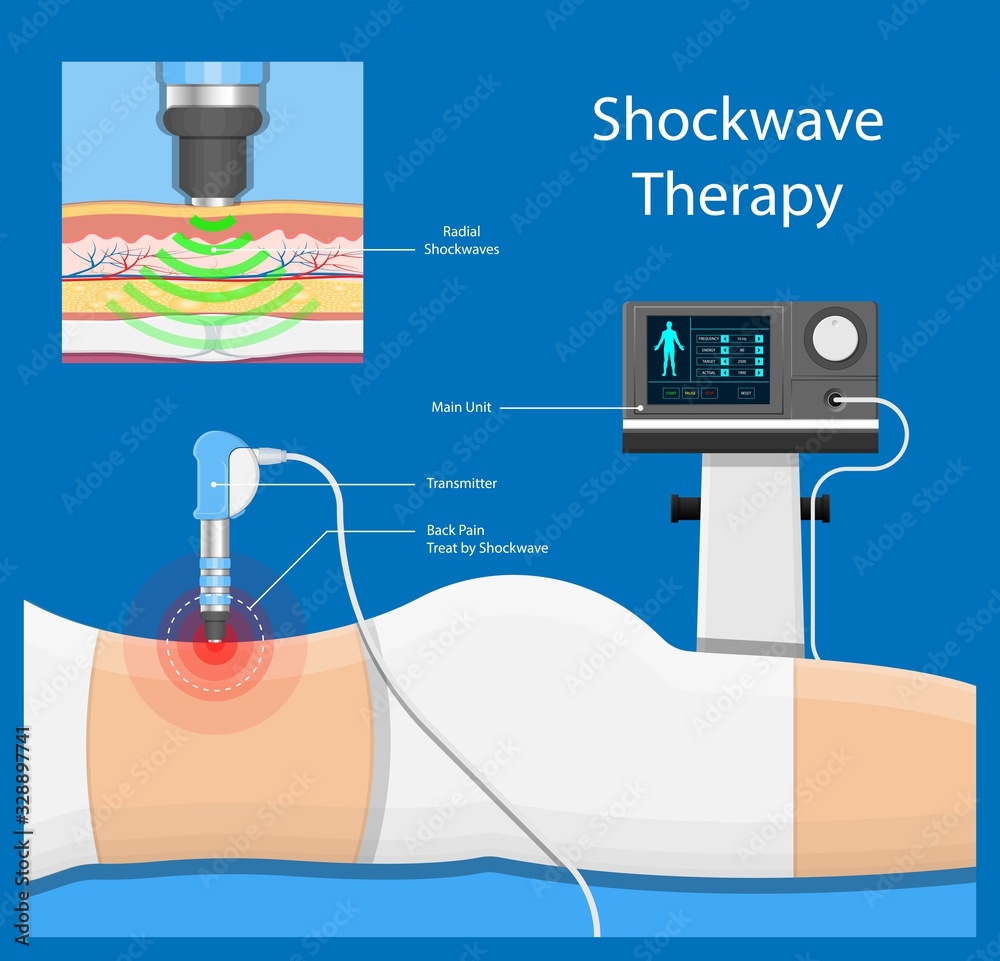 Shockwave therapy SWT physiotherapist treat muscular disorder back neck ...