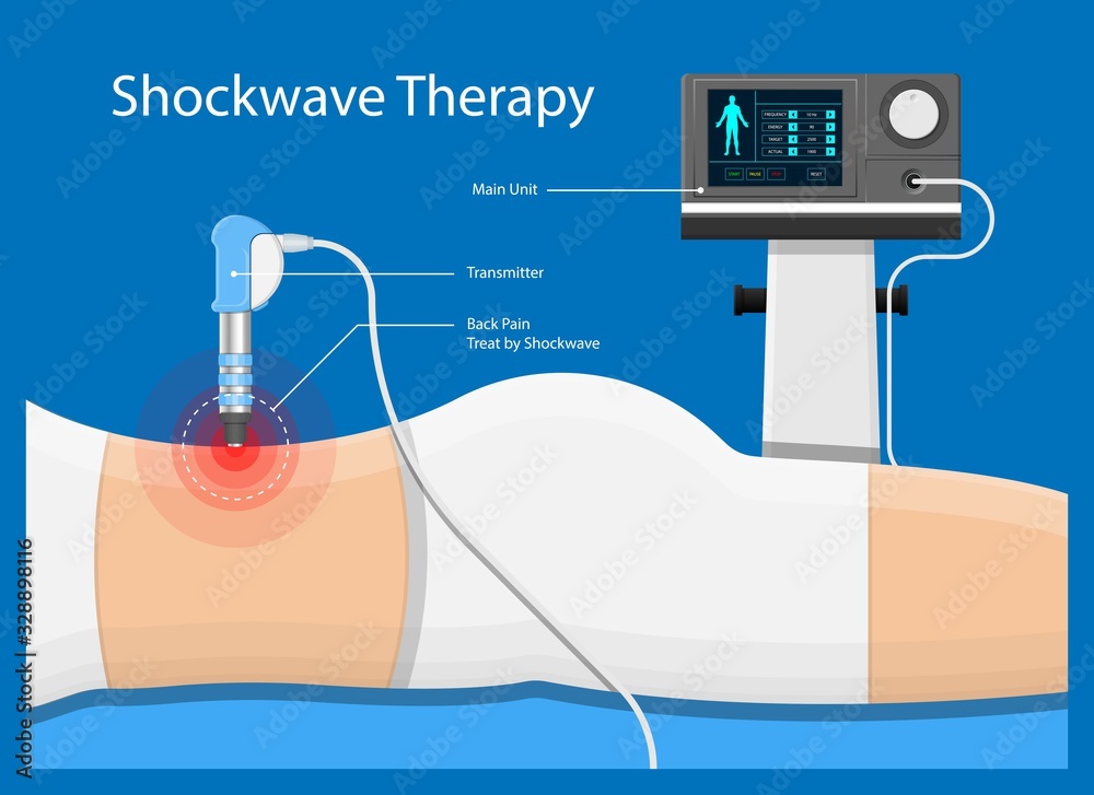 Shockwave therapy SWT physiotherapist treat muscular disorder back neck ...