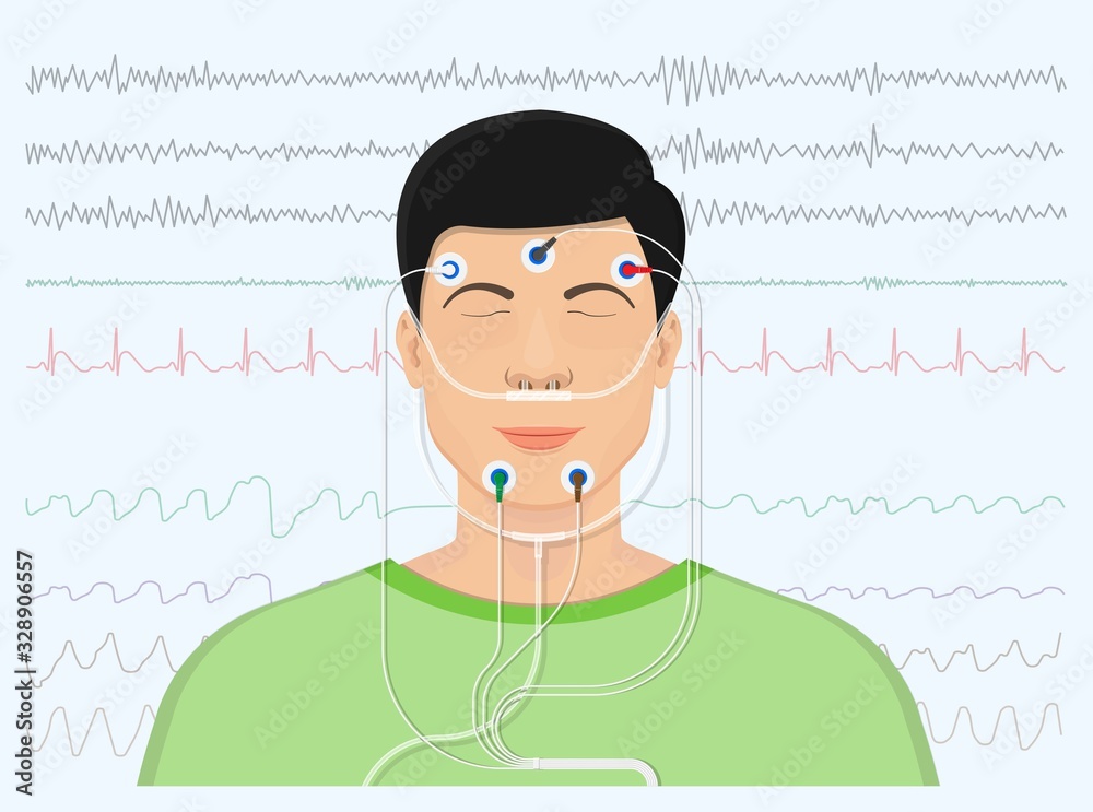 PSG sleep study test apnea diagnose Periodic limb movement disorder ...