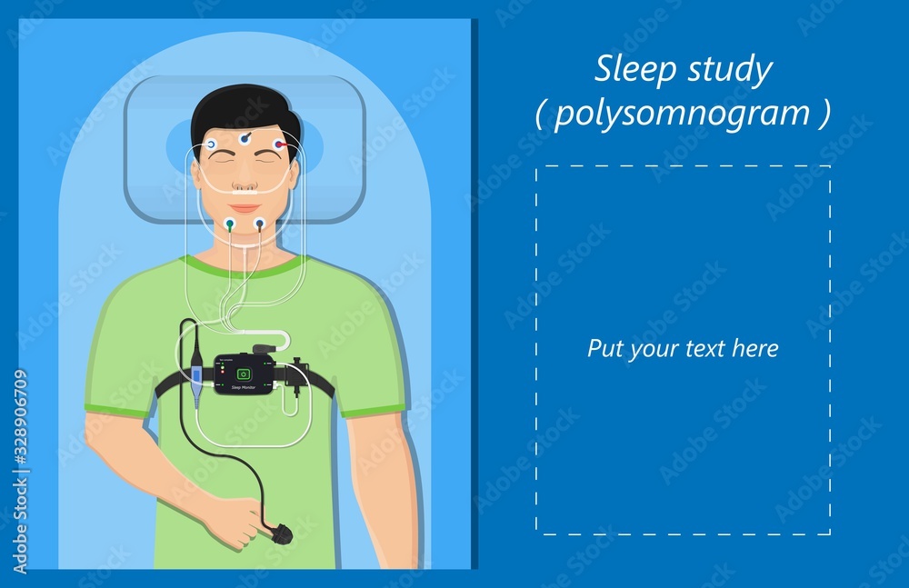 PSG sleep study test apnea diagnose Periodic limb movement disorder ...
