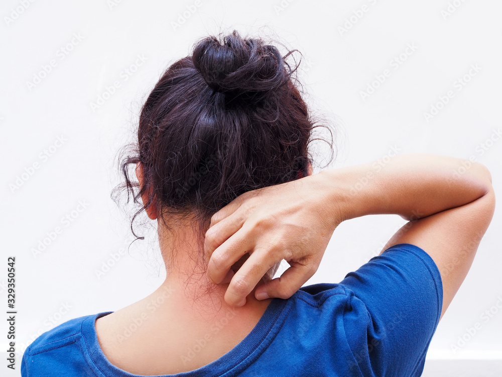 Asian woman scratching on neck with itching on skin from dermatitis ...