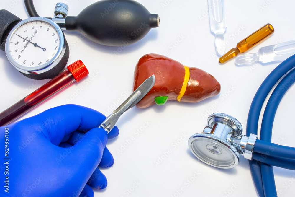 Concept photo of liver surgery, operation of liver resection or ...