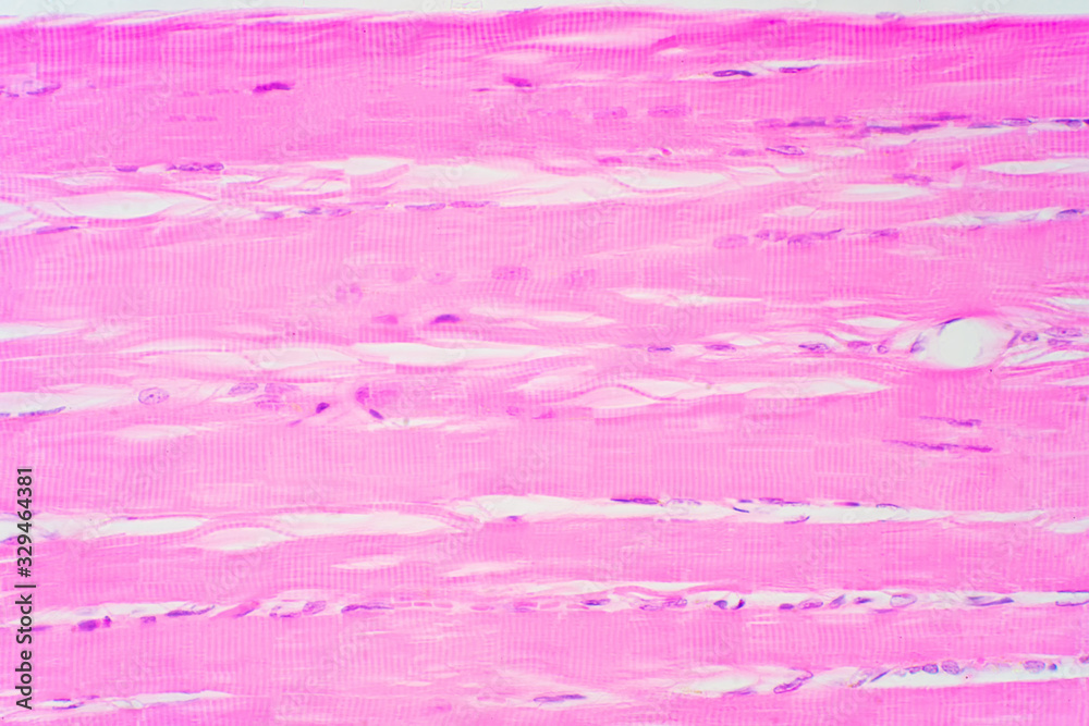 Human skeletal muscle under microscope view for education pathology ...