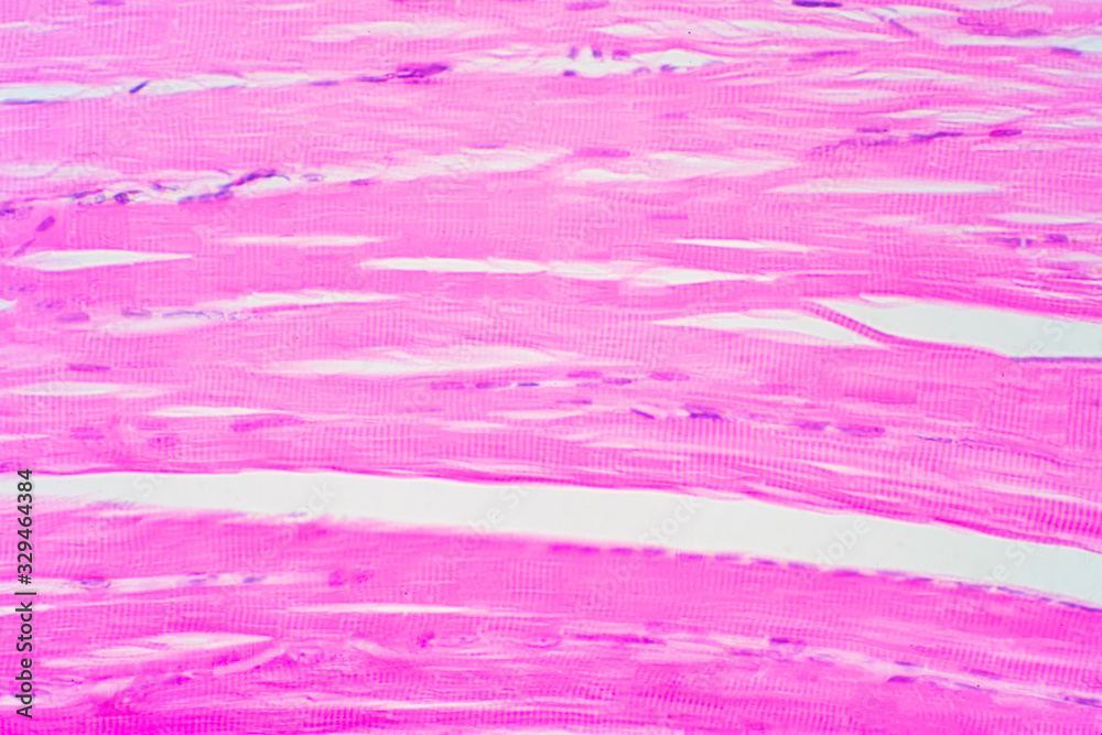 Human skeletal muscle under microscope view for education pathology ...