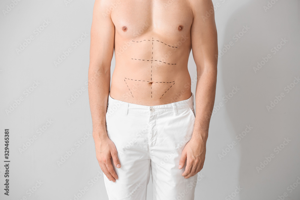 Young man with marks on his body against light background. Concept of ...