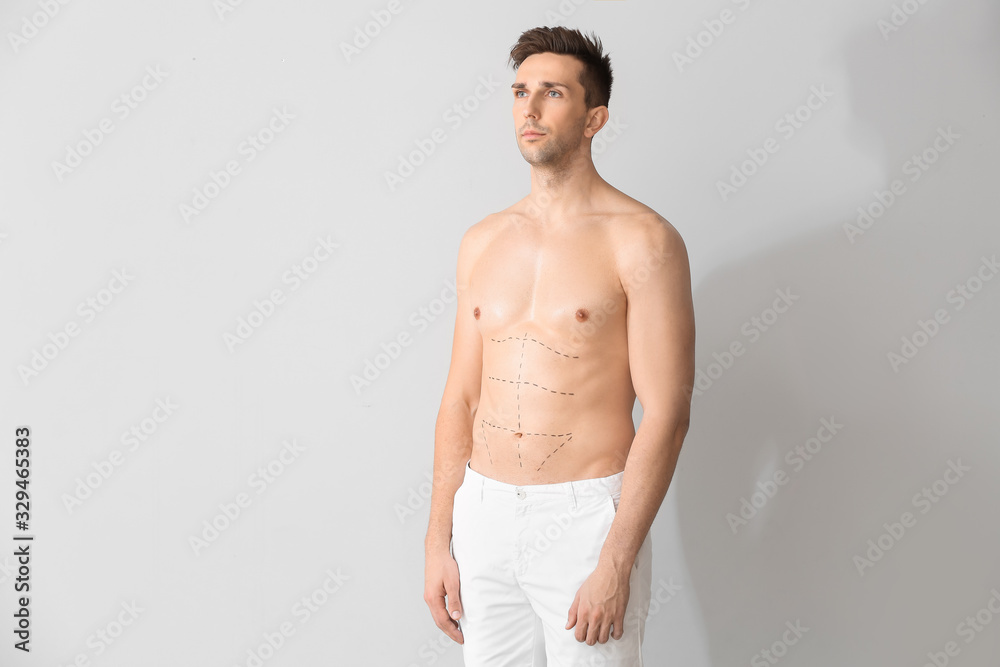 Young man with marks on his body against light background. Concept of ...