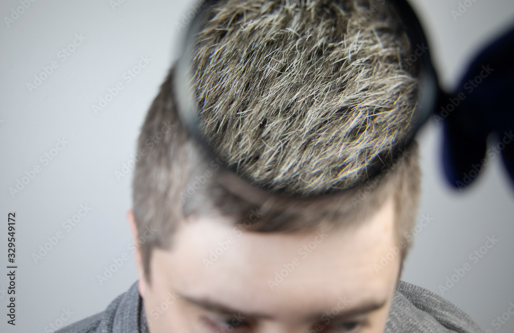 A trichologist examines a young man’s gray hair under a magnifying ...