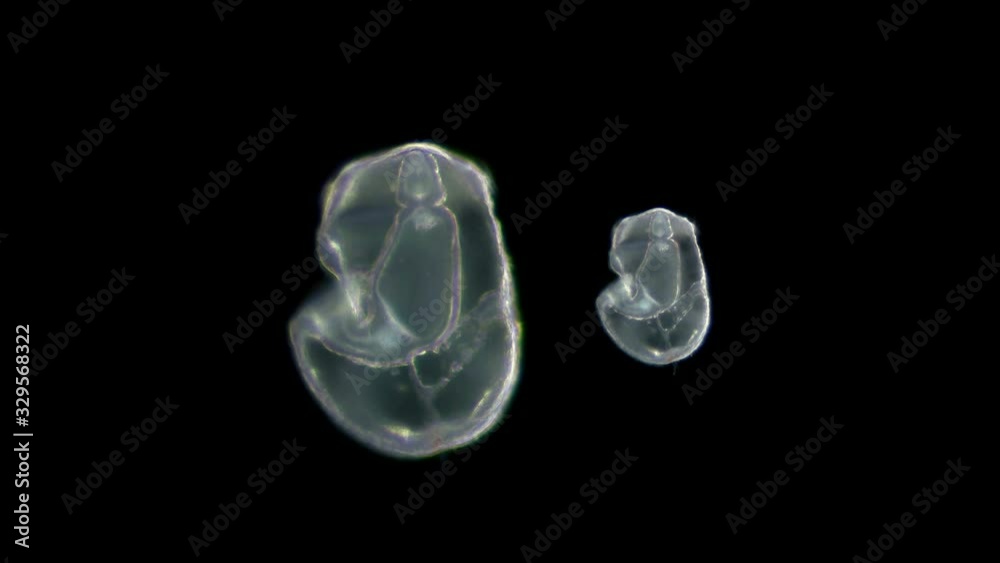 The larva of the starfish Asteroidea, under the microscope, is in the ...