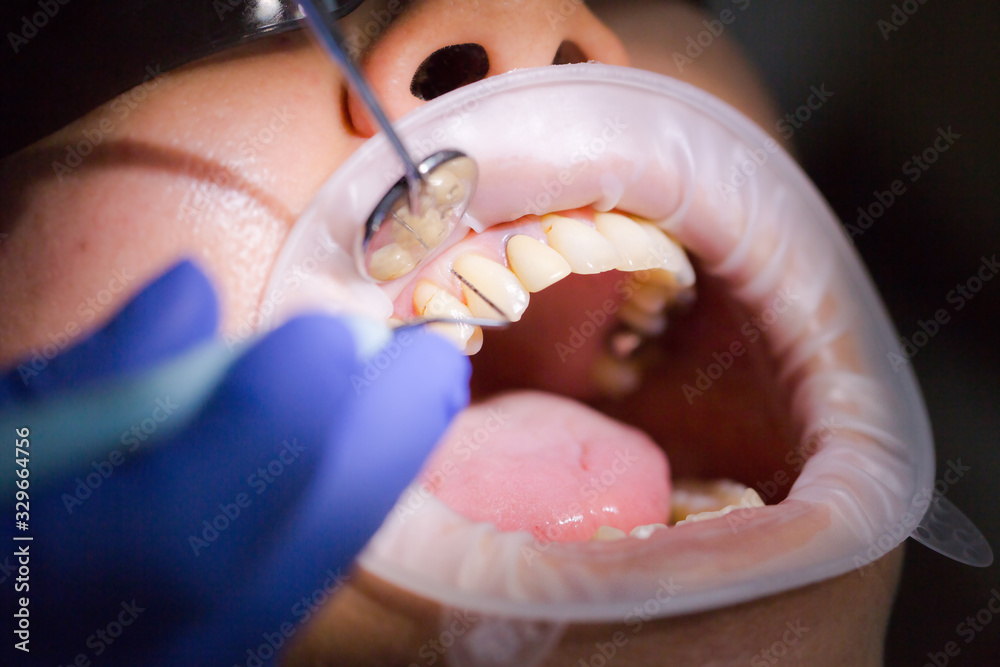 Asian female patient on dentist appointment during dental procedure ...
